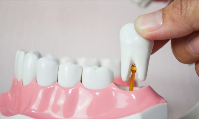 Tooth Extraction: What to Expect Before, During, and After the ...